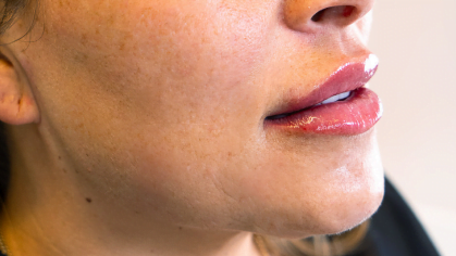 Anti Ageing by Dr Linea - Dr Linea